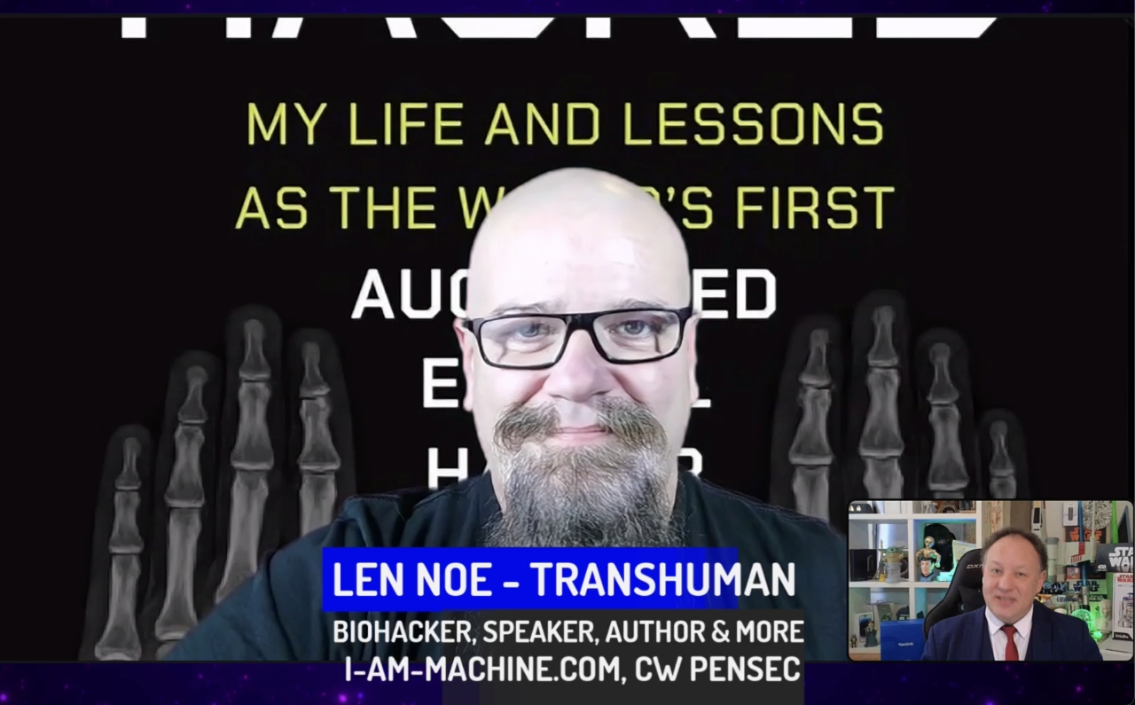iTWire - iTWire TV: 'I AM MACHINE' Len Noe has 11 bio implants, a ...